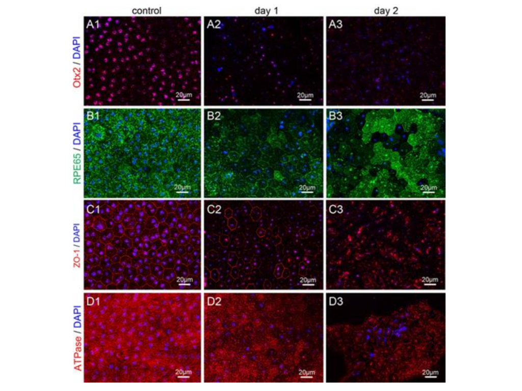 Characterization of a mouse model with complete RPE loss and its use ...